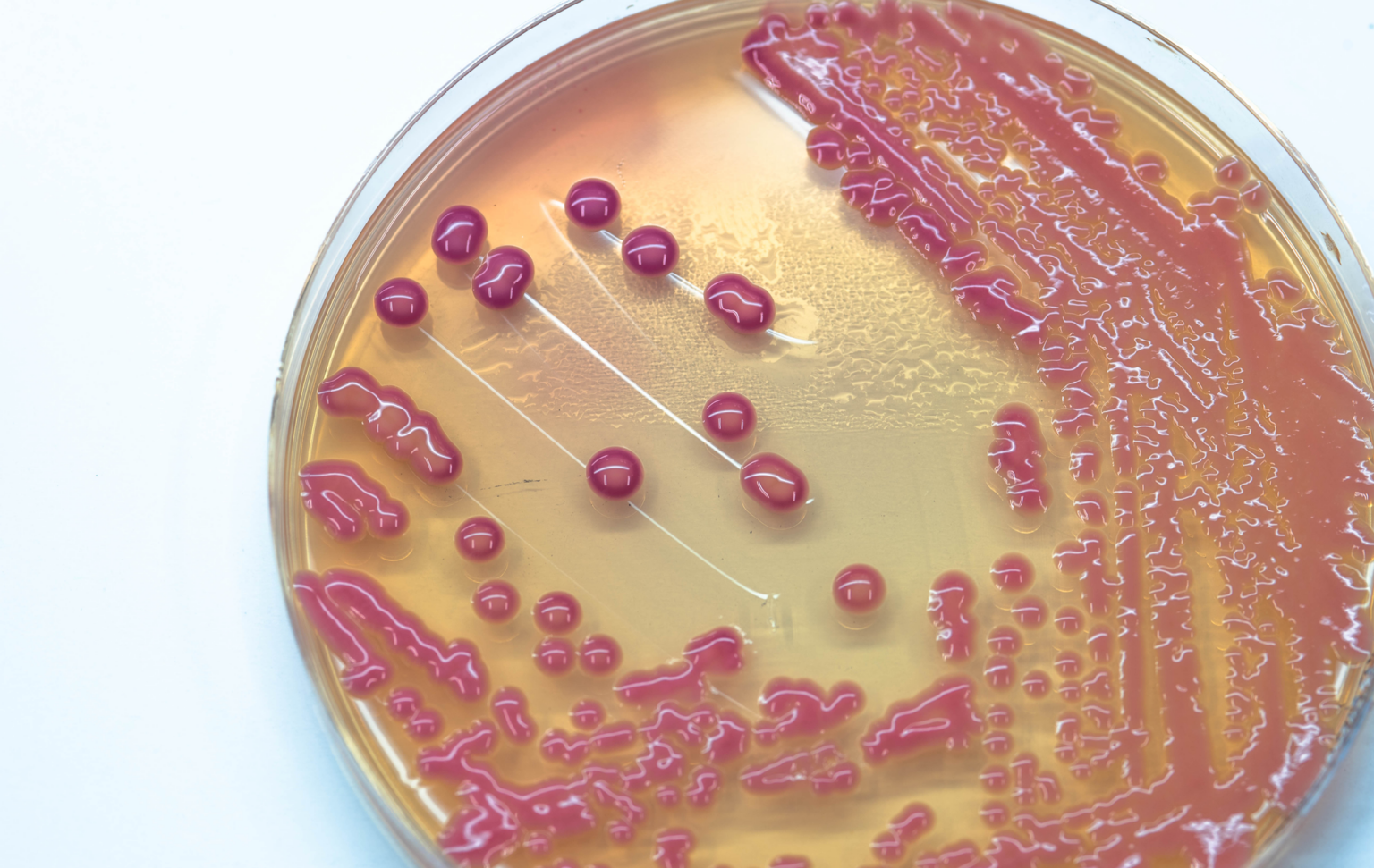 Sputum Processing for the 21st Century - Medical Wire & Equipment Co Ltd