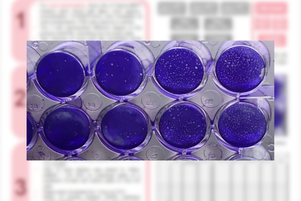 Evaluating the Efficacy of SIGMA-MM™ Transport Medium for the ...